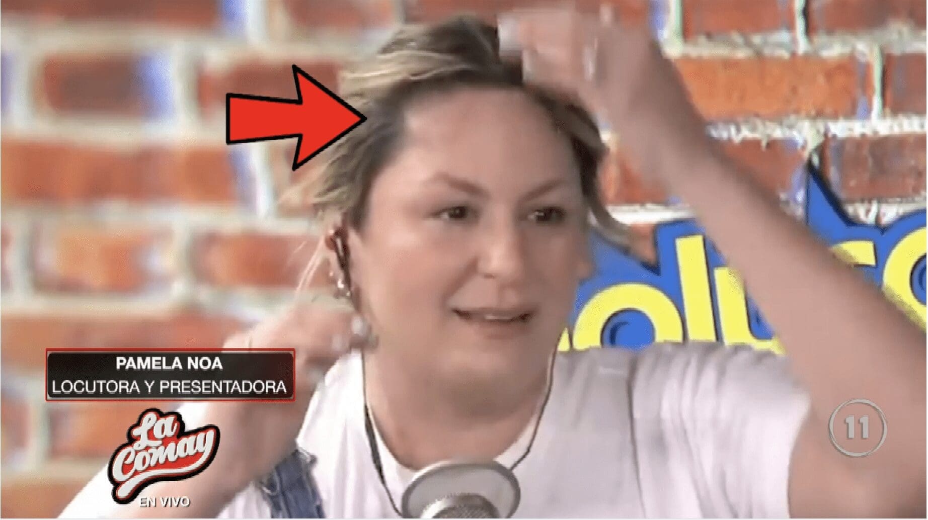 Pamela Noa se golpea con una puerta y se hace tremendo chichón ...