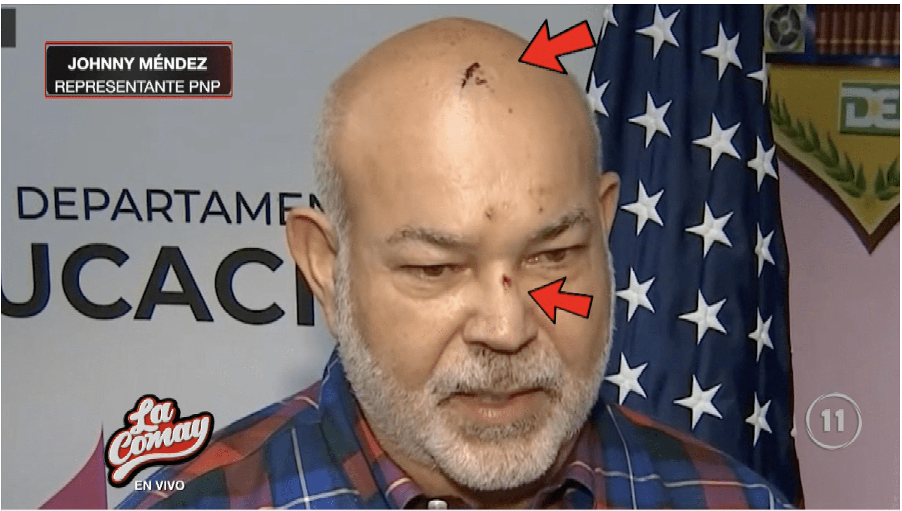 ¿Qué le pasó a Johnny Méndez? - TeleOnce TV | Vívelo