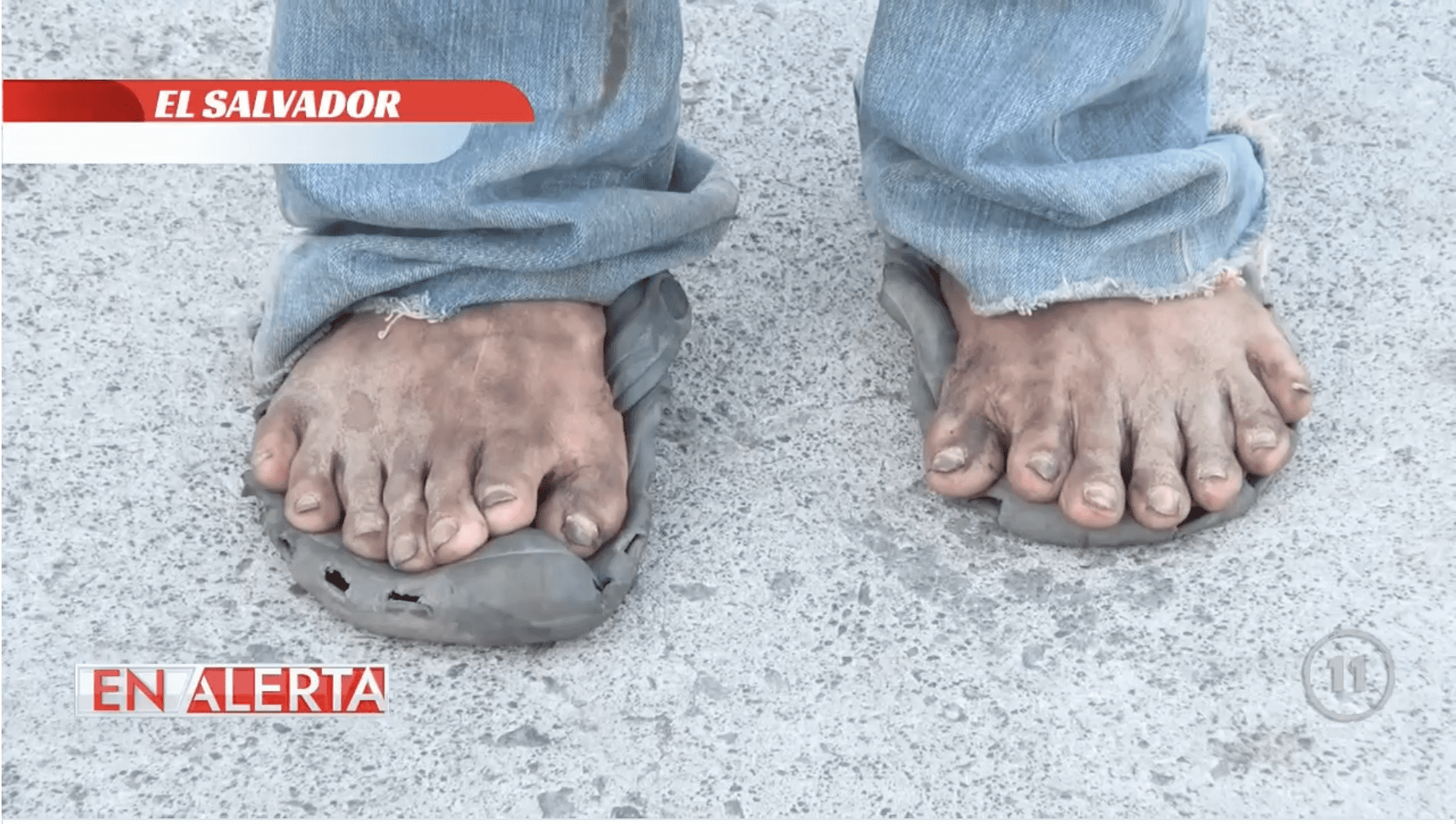 Conoce la historia del "niño pulpo" - TeleOnce TV | Vívelo